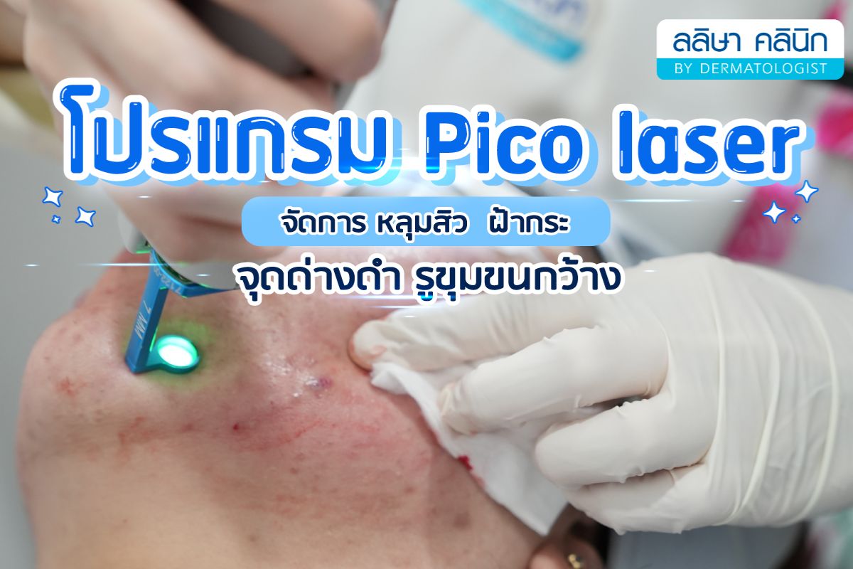 Pico Laser คืออะไร ช่วยอะไร มีกี่แบบ ทำครั้งแรกต้องรู้เรื่องอะไรบ้าง ...