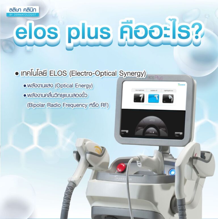 elos plus laser ทางเลือกในการรักษารอยสิวอย่างมีประสิทธิภาพ - คลินิก ...