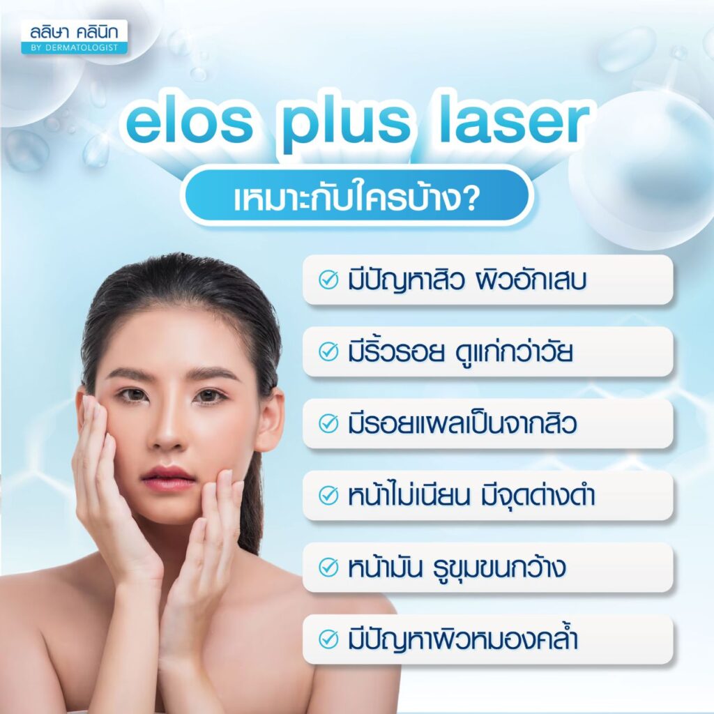 elos plus laser ทางเลือกในการรักษารอยสิวอย่างมีประสิทธิภาพ - LALIZA Clinic