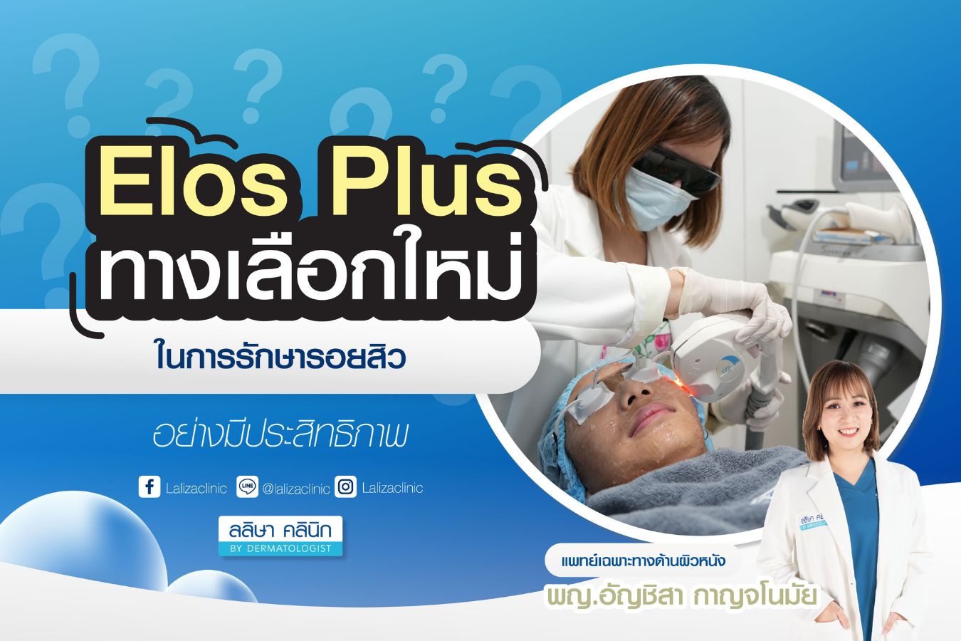 elos plus laser ทางเลือกในการรักษารอยสิวอย่างมีประสิทธิภาพ - คลินิกผิวหนังลลิษา โดยแพทย์เฉพาะทาง