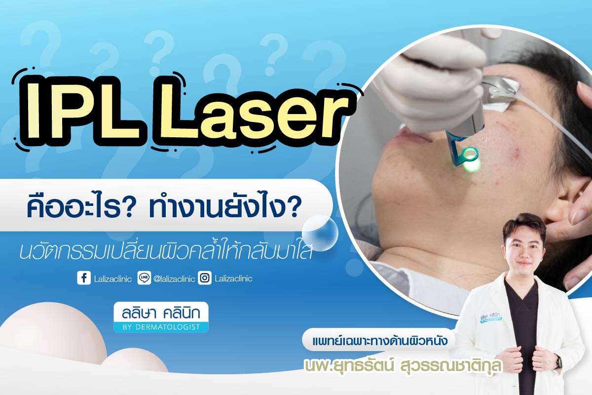 IPL Laser คืออะไร? ดีจริงไหม? พร้อมไขข้อสงสัยเรื่องผลลัพธ์เหมาะกับใคร?