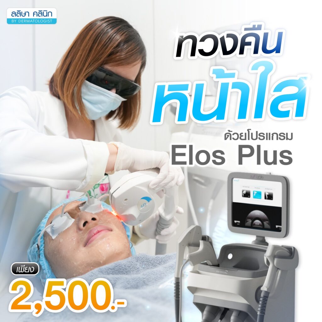 เลเซอร์รอยสิว ราคาเท่าไหร่? เช็กก่อนตัดสินใจรักษา แบบไหนคุ้มค่าที่สุด ...